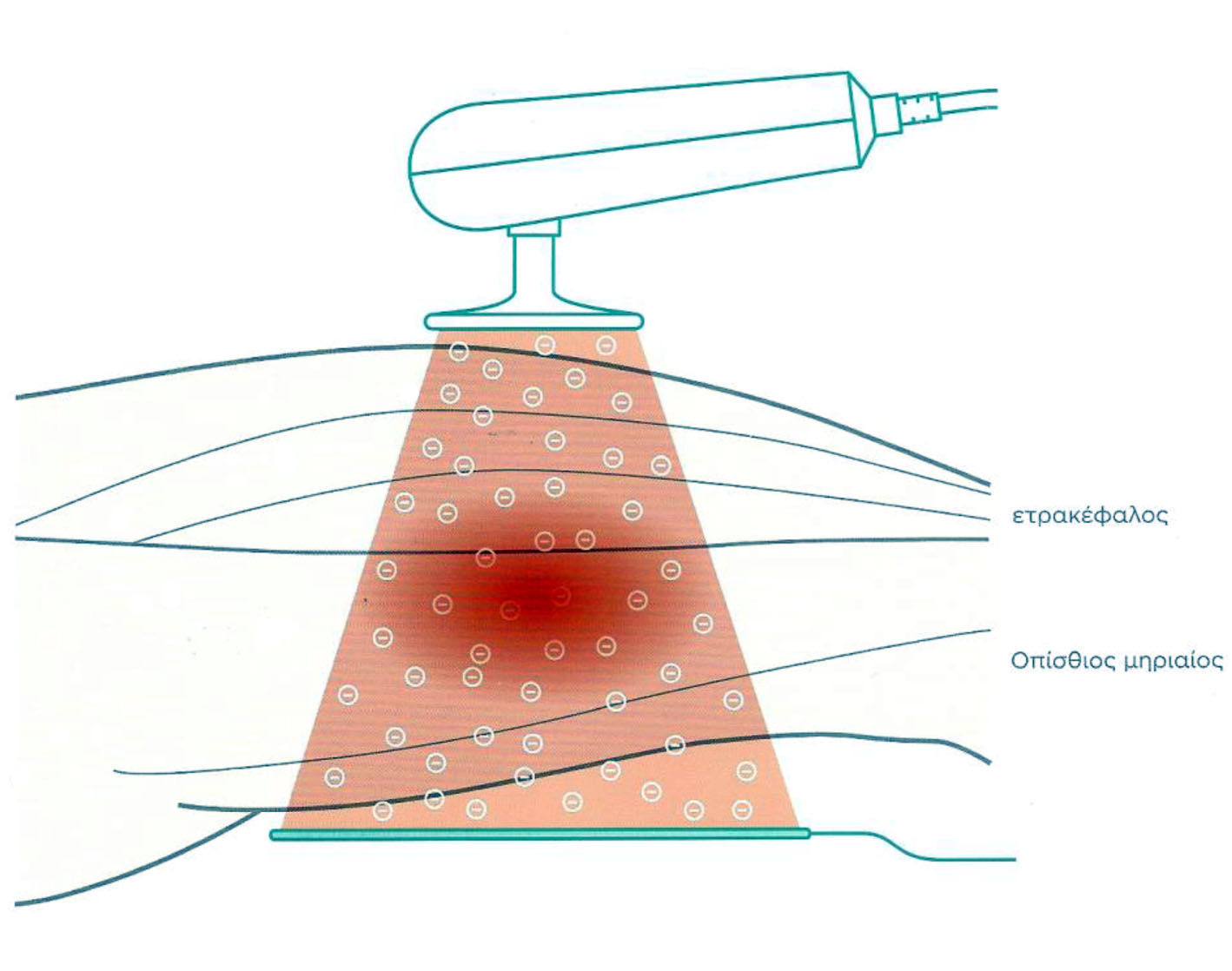 TECAR – healthflex2